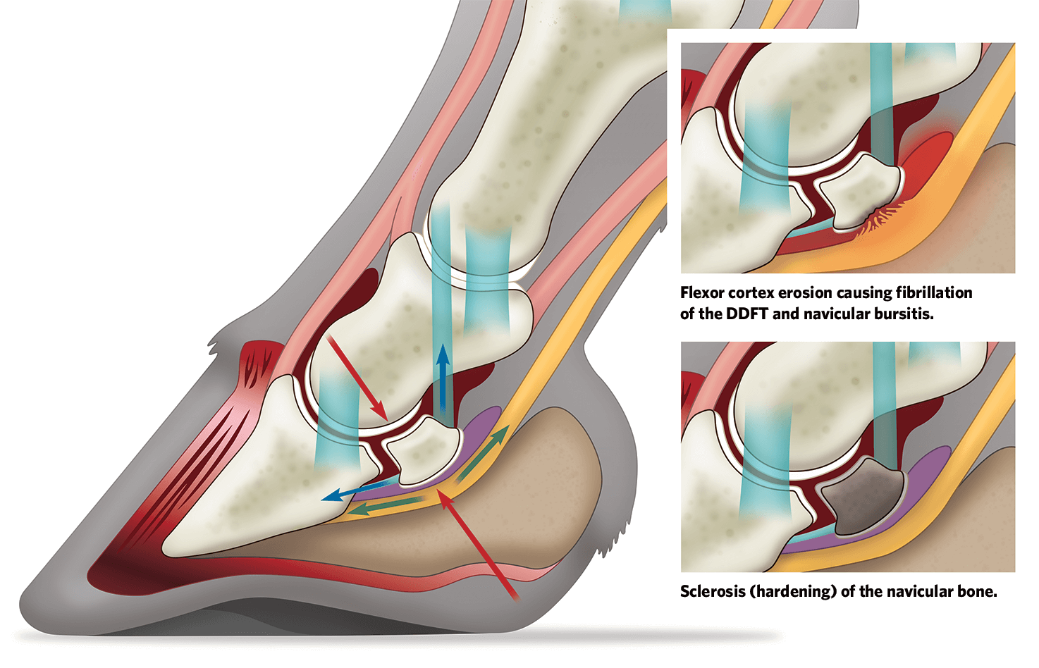 Navicular Syndrome: A Better Understanding
